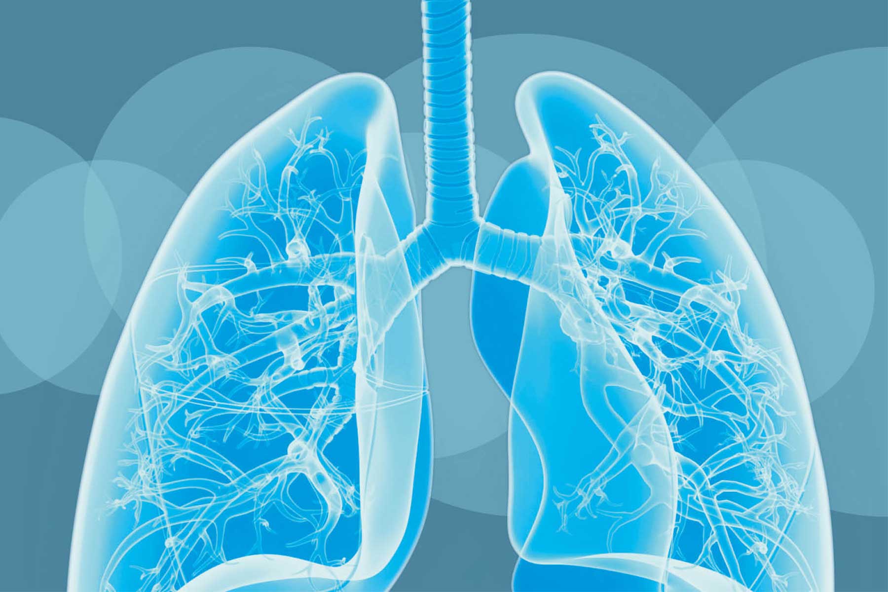 Chris Bolliger Award | Respiration | Karger Publishers