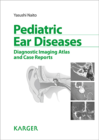 Pediatric Ear Diseases. Diagnostic Imaging Atlas and Case Reports ...