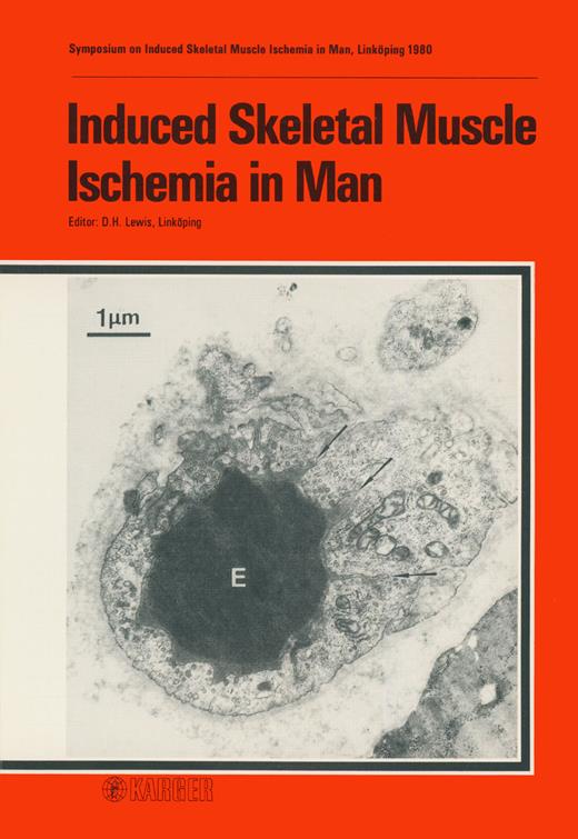 Microcirculation and Ischemia | Induced Skeletal Muscle Ischemia in ...