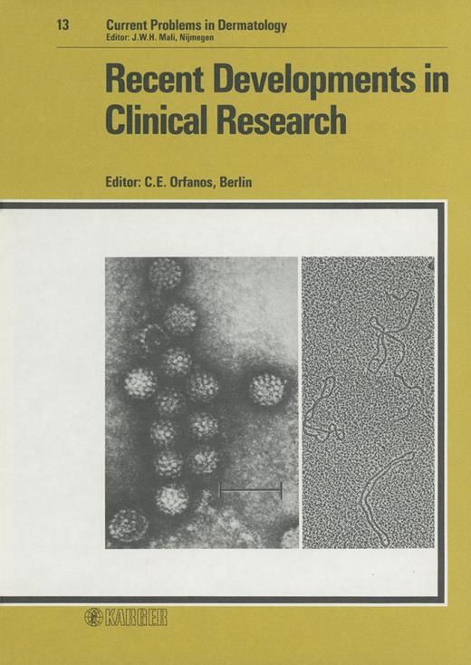 Modern Aspects of Scabies | Recent Developments in Clinical Research ...