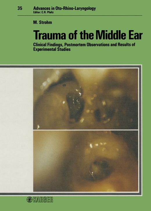 Trauma of the Middle EarClinical Findings, Postmortem Observations and ...