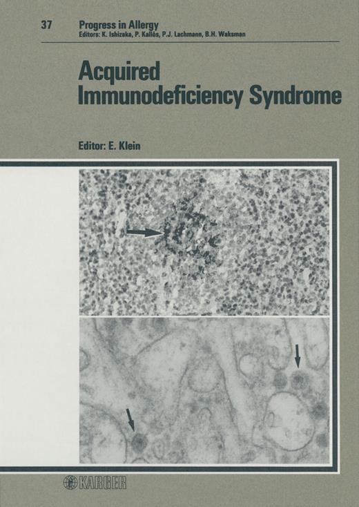 Spectrum of Morphologic Changes of Lymph Nodes from Patients with AIDS ...
