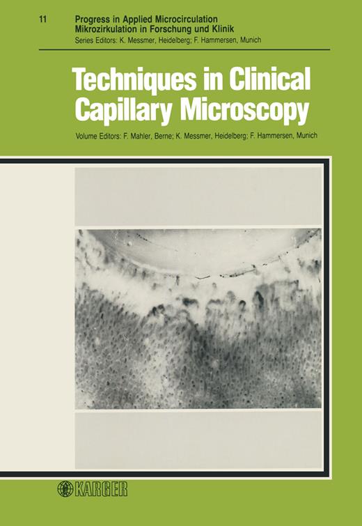 The Use of Capillaroscopy in the Evaluation of Skin Viability ...