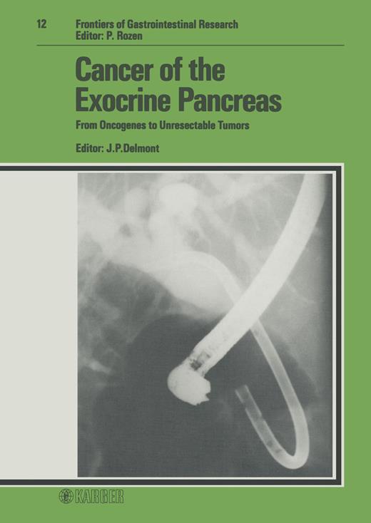 Tumor Markers in Cancer of the Pancreas | Cancer of the Exocrine ...