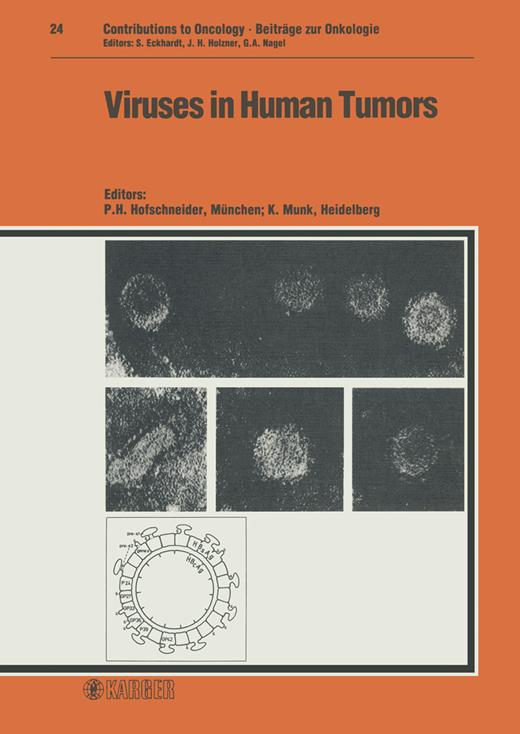 LAV Virus, the Etiological Agent of AIDS | Viruses in Human Tumors5th ...