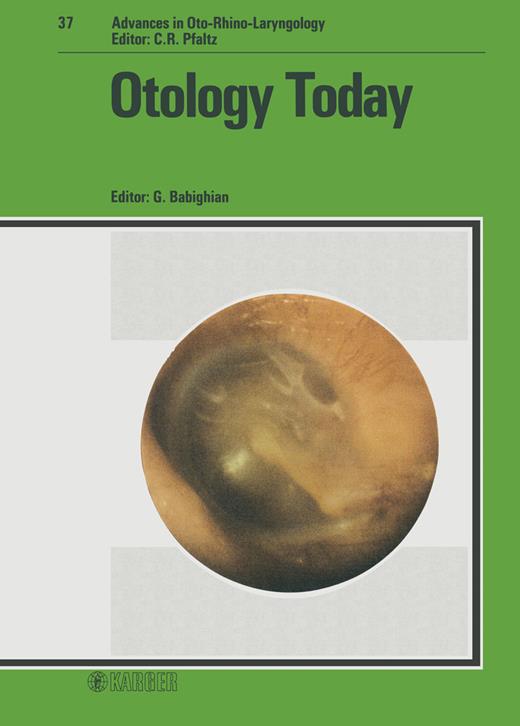 Transplantation of Nasal Mucosa into the Middle Ear for the Treatment of Adhesive Otitis media ...