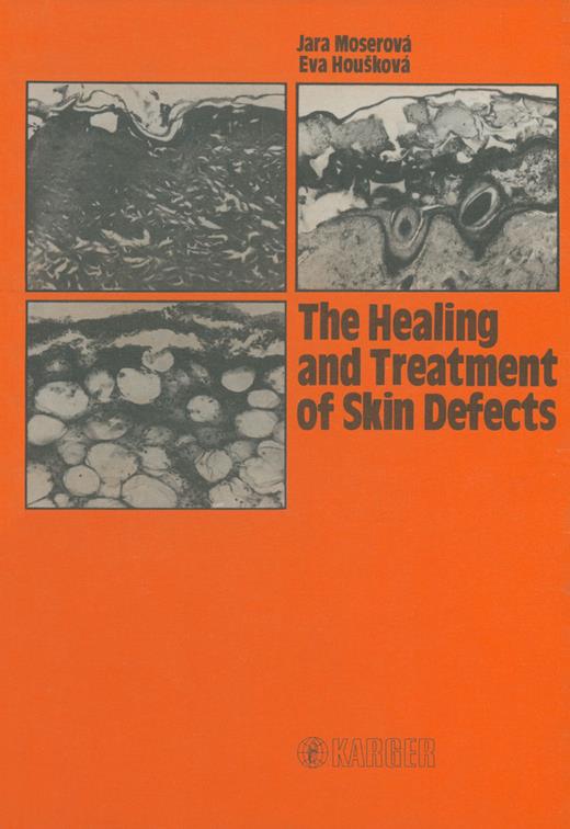 The Healing and Treatment of Skin Defects | Books Gateway | Karger ...