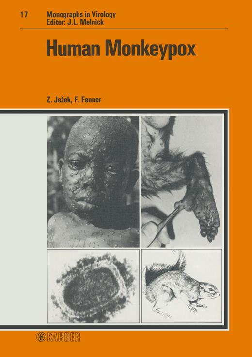 IV. Human Monkeypox: Discovery and Organization of Research | Human ...