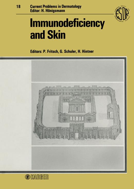 Scabies norvegica | Immunodeficiency and Skin: European Society for ...