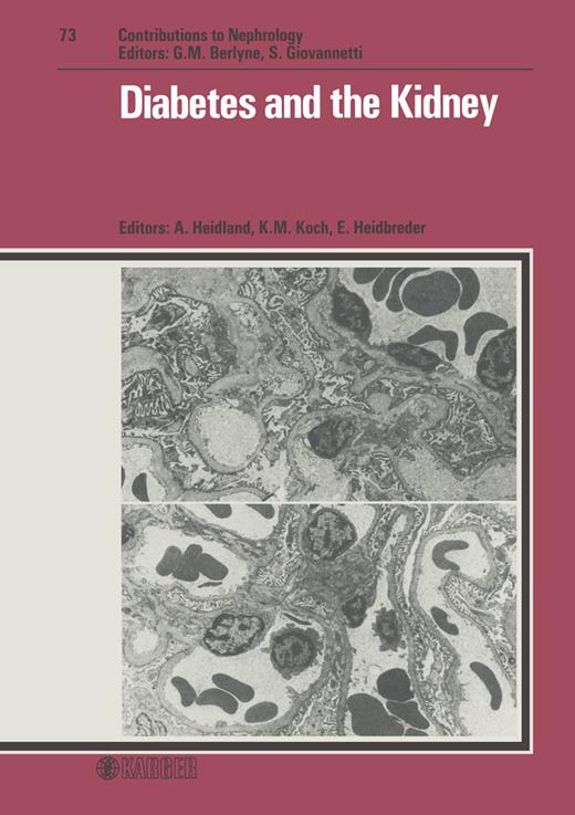 Kidney Transplantation in Diabetic Nephropathy | Diabetes and the ...