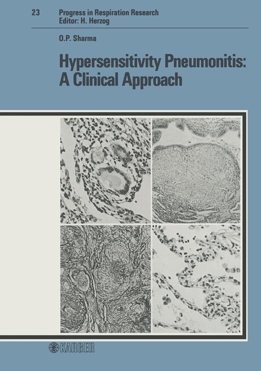 Hypersensitivity Pneumonitis: A Clinical Approach | Books Gateway ...