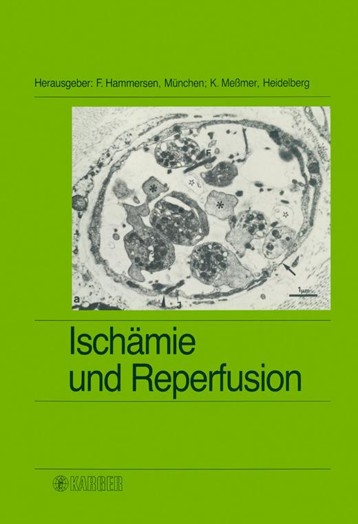 Ischämien des Darms und Reperfusion | Ischämie und Reperfusion7 ...