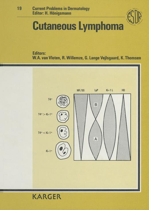 Cell Lineage Analysis in Cutaneous Lymphoid Infiltrates Using a Panel ...
