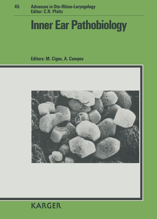 Tegmen AmpullaeA Study of the Roof of the Ampulla | Inner Ear ...