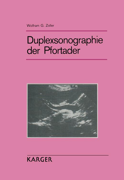 4. Methoden zur Untersuchung des Pfortadersystems | Duplexsonographie ...