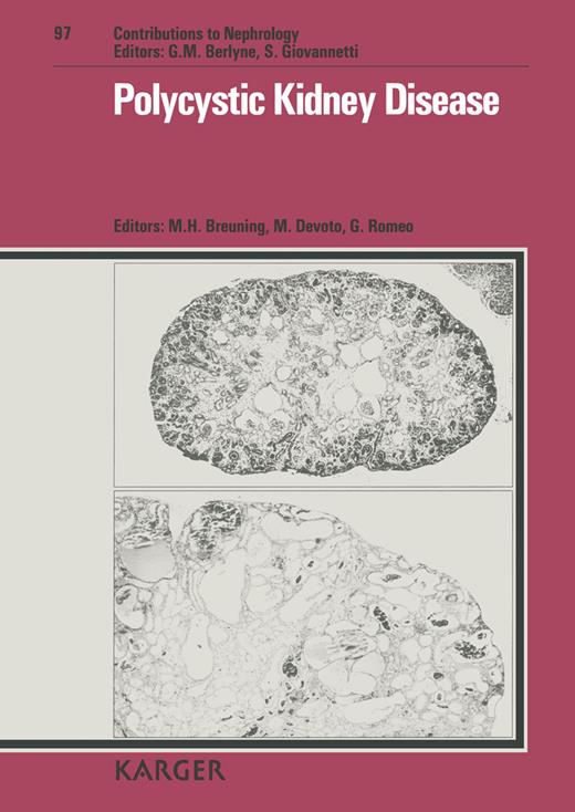 Pathophysiology of Renal Tubular Cyst Formation in Murine Models of ...