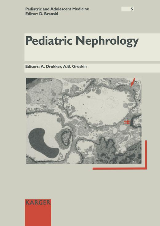 IgA Nephropathy in Childhood | Pediatric Nephrology | Books Gateway ...