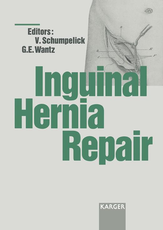 Gilbert Classification of Inguinal Hernias: An Anatomic and Functional ...
