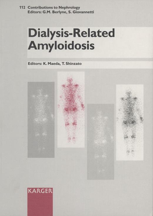 Prevention Of Dialysis Related Amyloidosis Using The Polyacrylonitrile