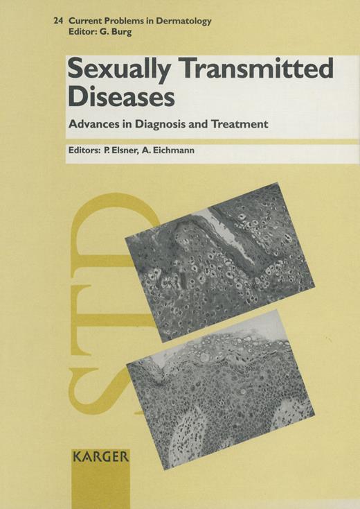 Laboratory Diagnosis of Syphilis | Sexually Transmitted Diseases ...