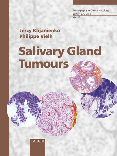 Salivary Gland Tumours | Books Gateway | Karger Publishers