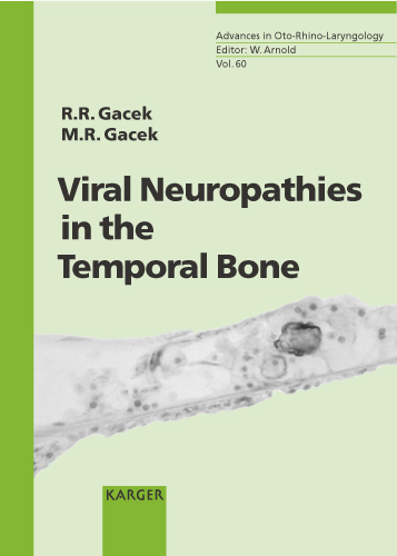 Vestibular Neuronitis: A Viral Neuropathy | Viral Neuropathies in the ...