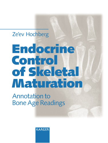 Other Diseases of Bone Growth and Maturation | Endocrine Control of ...