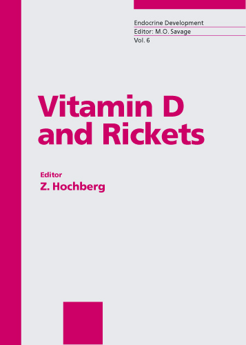 IntroductionRickets - Past and Present | Vitamin D and Rickets | Books ...
