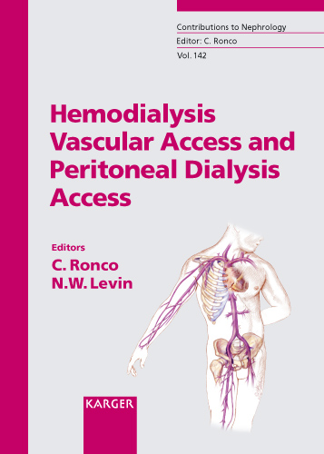 Chronic Central Venous Catheters for Dialysis and the Ash Split Cath ...