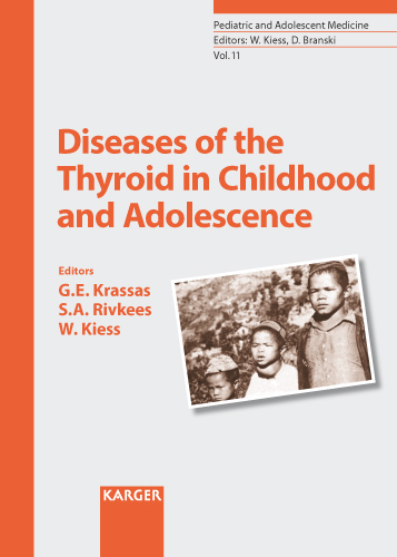 Treatment of Hyperthyroidism Due to Graves’Disease in Children ...