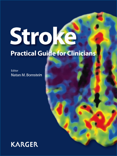 Stroke: Practical Guide for Clinicians | Books Gateway | Karger Publishers