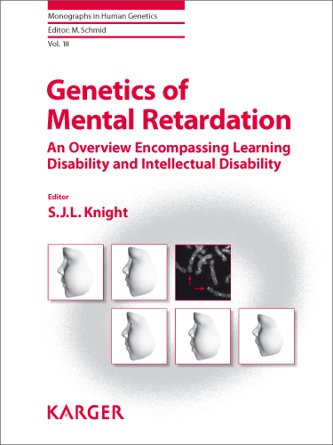 Monogenic Causes of Mental Retardation | Genetics of Mental RetardationAn Overview Encompassing ...