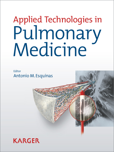 Awake Thoracic Epidural Anesthesia Pulmonary Resections Applied