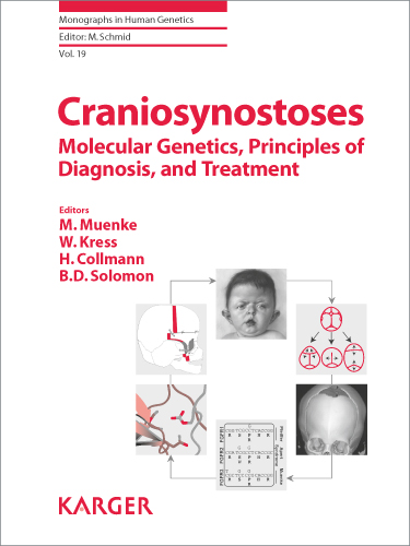 Muenke Syndrome | CraniosynostosesMolecular Genetics, Principles of ...