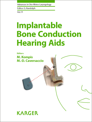 The Ponto Bone-Anchored Hearing System | Implantable Bone Conduction ...