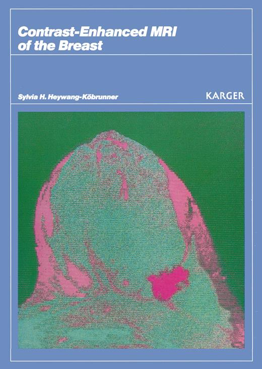 Present state and future aspect | Contrast-Enhanced MRI of the Breast ...