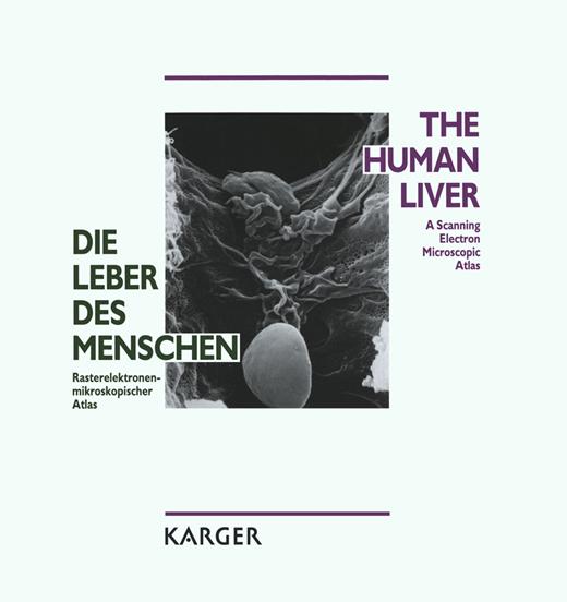 Die Leber des Menschen / The Human LiverRasterelektronenmikroskopischer ...