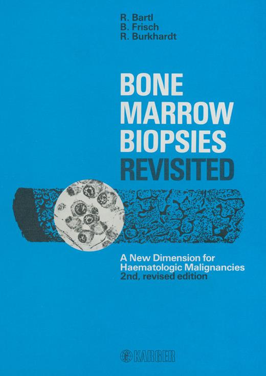 Bone Marrow Biopsies Revisited: A New Dimension for Hematologic ...