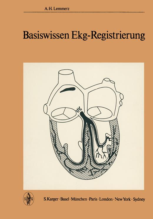 Lektion 11 Das Ekg nach FRANK | Basiswissen EKG-Registrierung | Books ...
