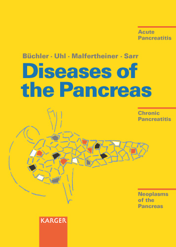 Neoplasms of the Pancreas | Diseases of the PancreasAcute Pancreatitis ...