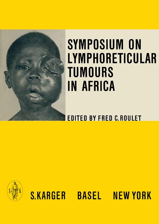 Cytology and Histochemistry of the Malignant Lymphomas Seen in Uganda ...
