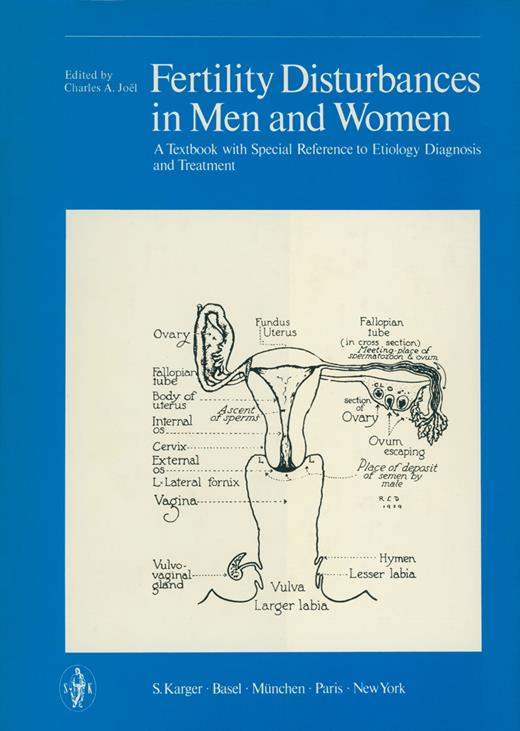 Recent Advances Concerning the Role of Varicocele in Male Infertility ...