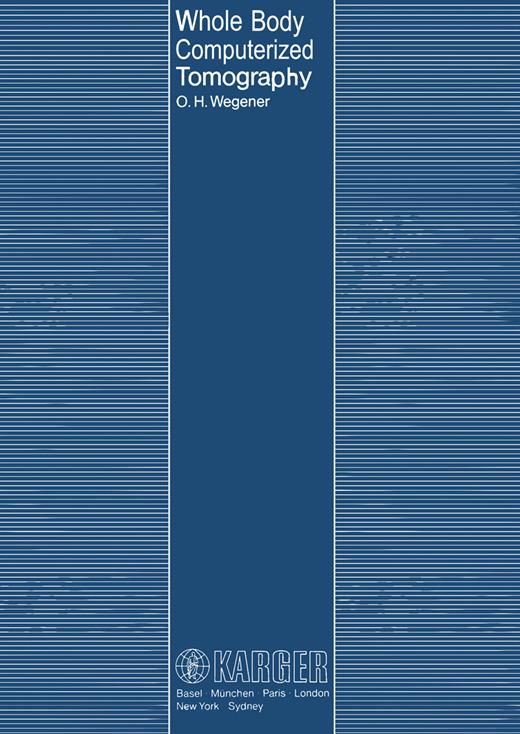 Indications for whole body computerized tomography | Whole Body ...