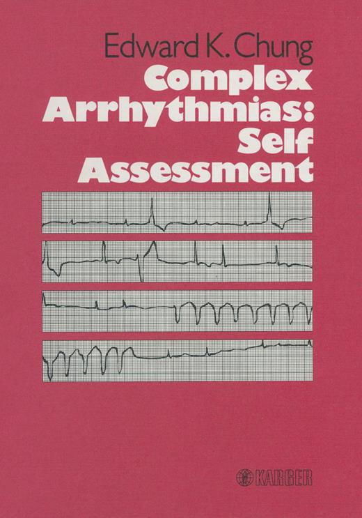 Case 91 A-V junctional escape rhythm | Complex Arrhythmias: Self ...