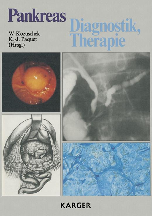 Konservative Therapie der akuten Pankreatitis | PankreasDiagnostik ...