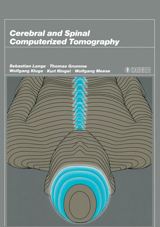 Cerebral and Spinal Computerized Tomography | Books Gateway | Karger ...