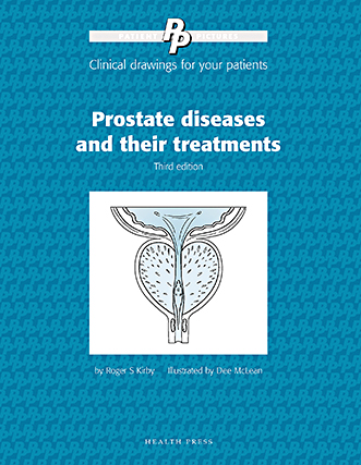 Patient Pictures: Prostate diseases and their treatments: Clinical ...