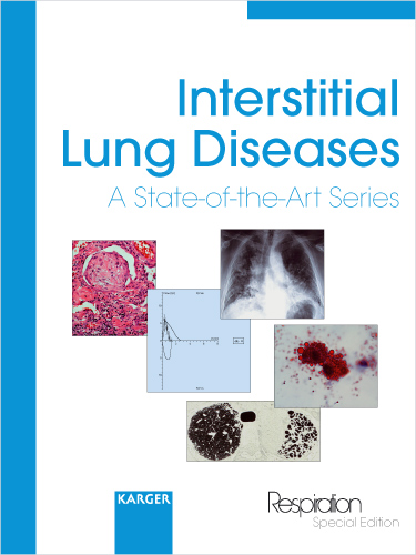 Interstitial Lung DiseasesA State-of-the-Art Series | Books Gateway ...