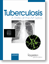 Tuberculosis: A State-of-the-Art Series | Books Gateway | Karger Publishers