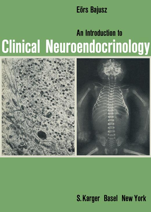 Gonadal Dysfunction Associated with Congenital or Abiotrophic Diseases ...